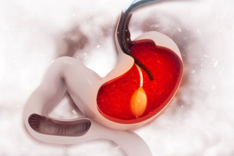 Gastroscopy, Stomach Endoscopy, Gastroscopy Examination and Fees - Hong ...